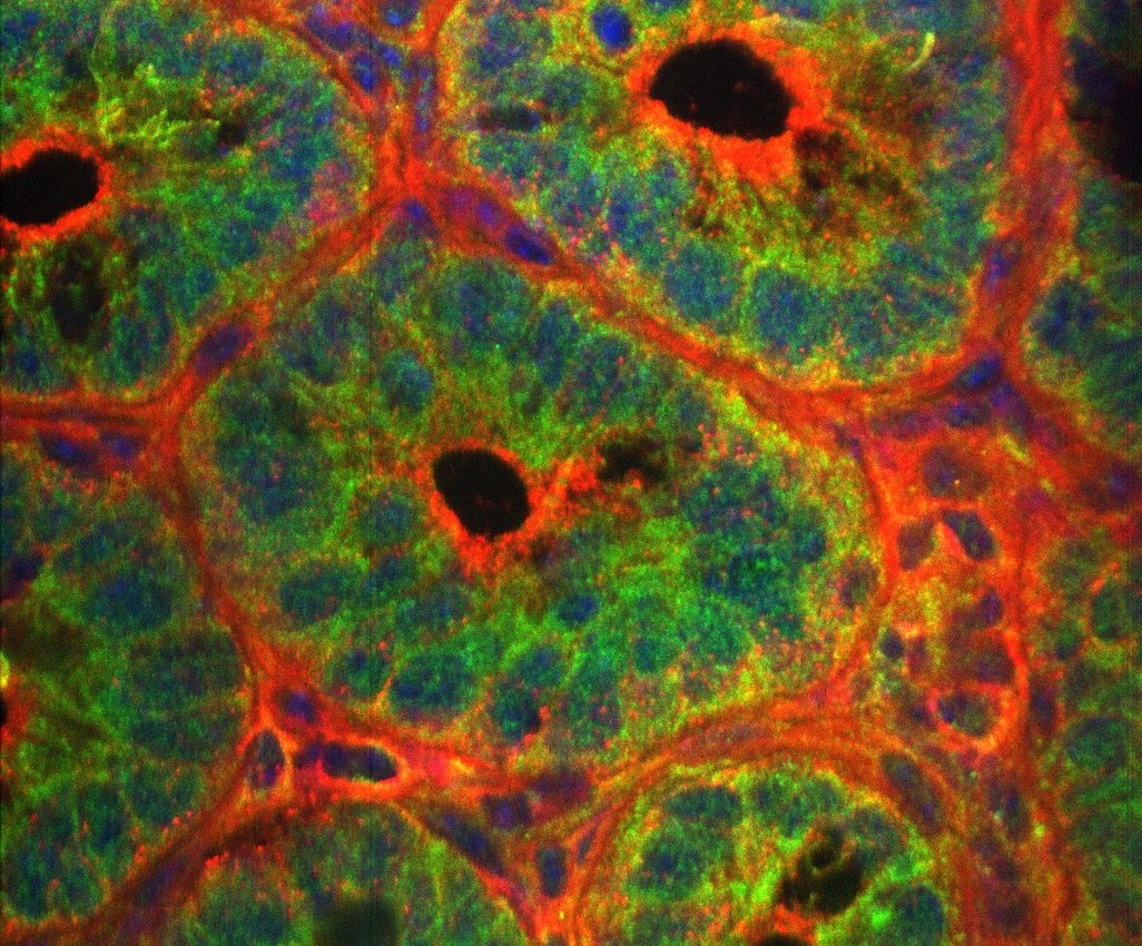 Šta je autofagija i koja je njena uloga u organizmu? | Časopis Simbioza